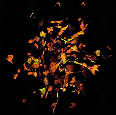 Image result for Cardiac Reprogramming