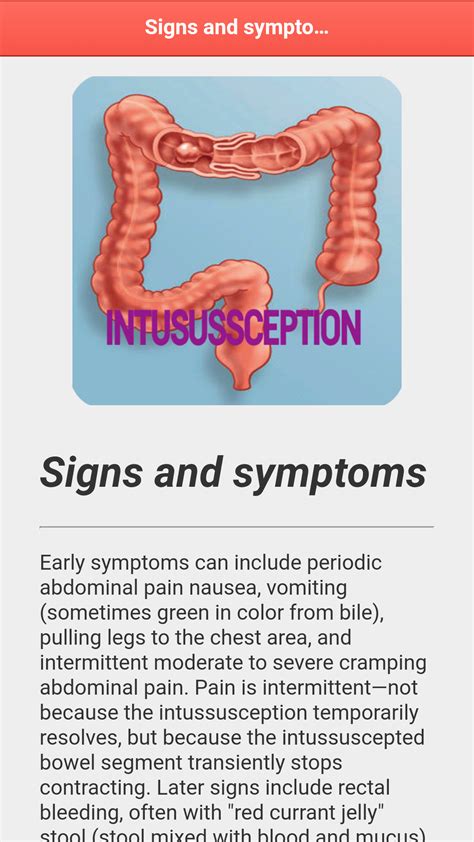 Image result for Intussusception in Arabic