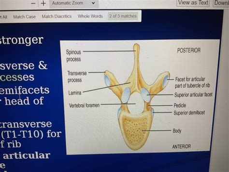 Image result for Sharp Slender Process