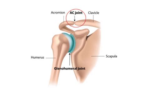 Image result for AC Joint Dysfunction