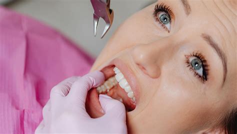 Image result for Tooth Out Pull Fail