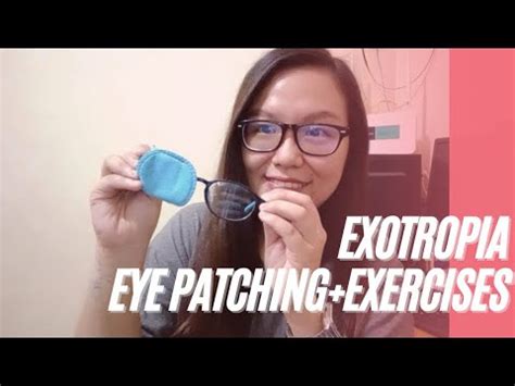 Image result for Visual Exercises for Exotropia