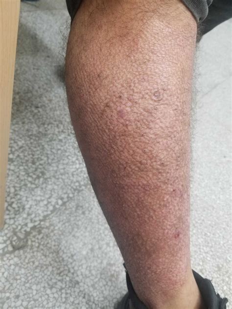 Image result for Shear Modulus Definition