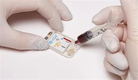 Image result for Gemstat ABG Machine