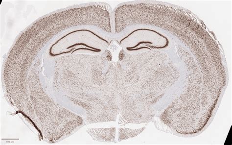 Image result for Multiplex IHC Neun