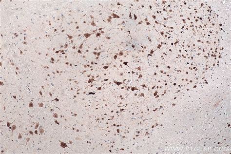 Image result for Multiplex IHC Neun