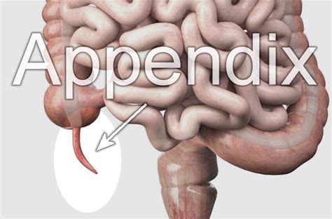 Image result for Appendix WHA Is It