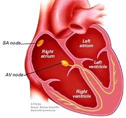 Image result for AV Node