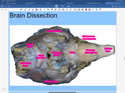 Image result for Brain Dissection