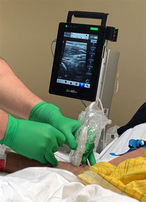 Image result for IV Line Infiltration