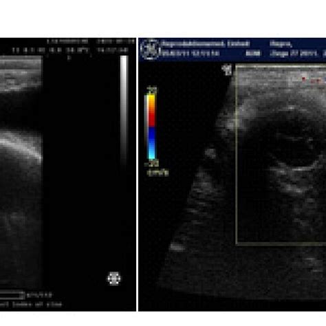 Image result for Scanned Linear Array