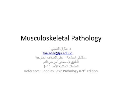 Image result for Types of Abnormal Bone Formation