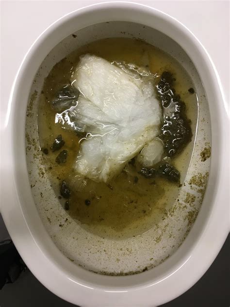 Image result for Clogged Poop