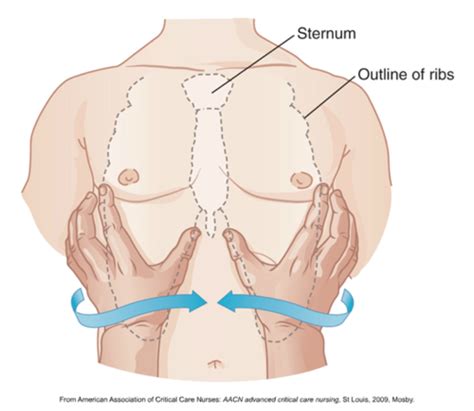 Image result for Sternal Spring Test