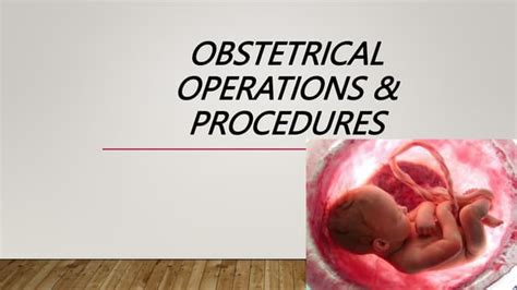 Image result for Obstetrical Version Procedure