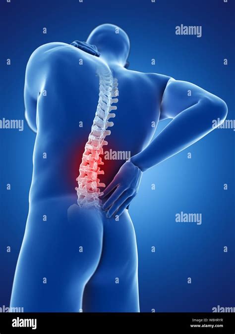 Image result for Back Pain in Computer