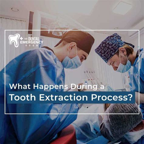 Image result for Tooth Extraction Process