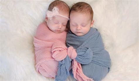 Image result for Java Island Siamese Twins