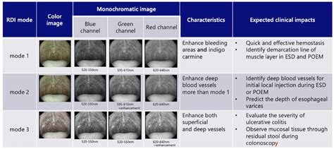 Image result for Scan RDI