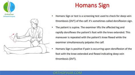 Image result for Positive Homans Sign