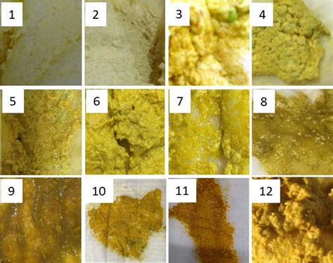 Image result for Yellow Stool Poop