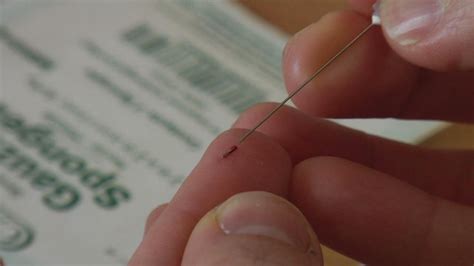 splinter removal with needle | Splinter removal, How to draw hair, Hair