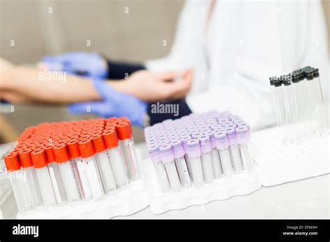Image result for Sampling Methods for Clinical Laboratory