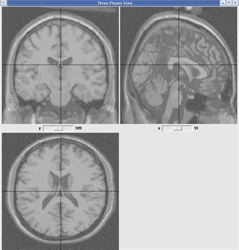 Image result for Tissue Classification Neural Network