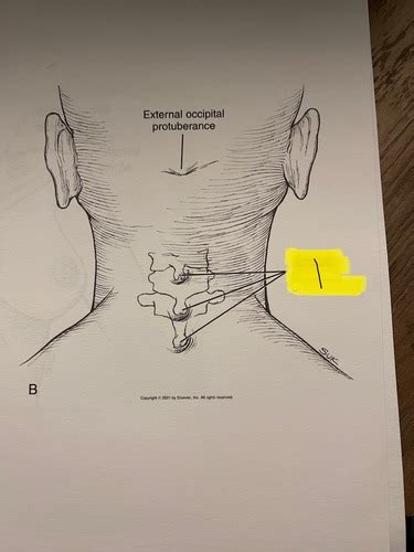 Image result for Sharp Slender Process