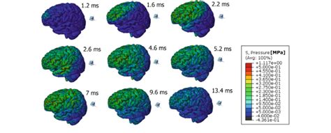 Image result for Stack Play Pressure Map