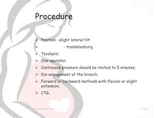 Image result for External Cephalic Version Procedure