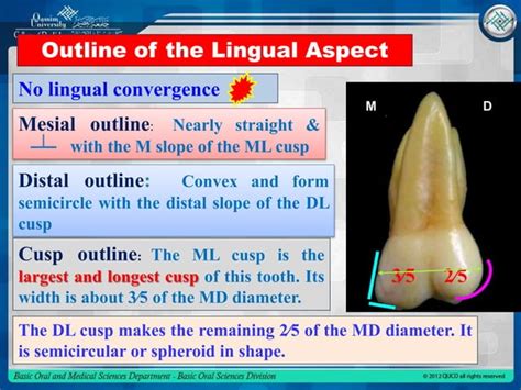 Image result for Maxillary First Molar