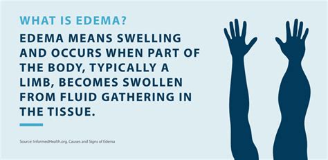 Image result for Cellulitis Toe