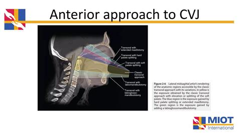 Image result for X-Rays for Basilar Invagination