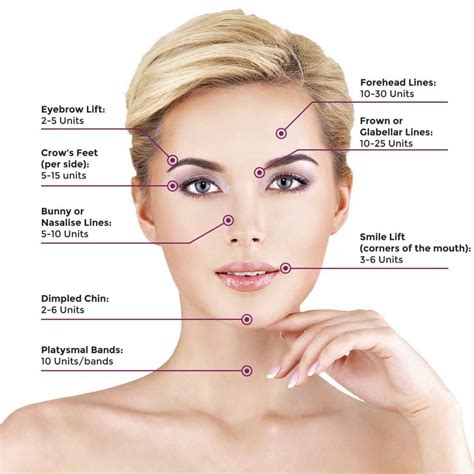 Image result for Botox Injection Face Chart