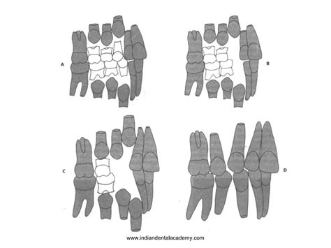 Image result for Serial Extraction Process