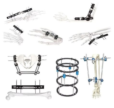 Image result for External Fixator Surgery