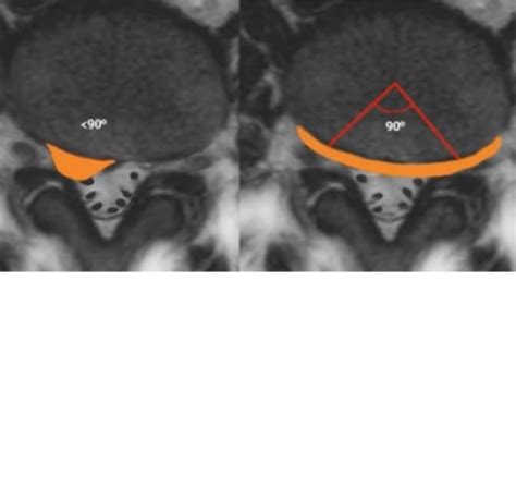 Image result for How to View MRI Disc