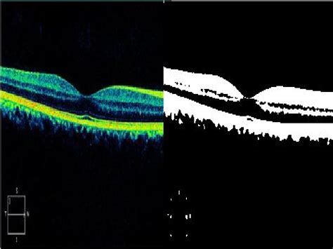 Image result for Thresholding MATLAB