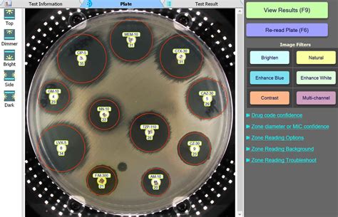 Image result for Disadvantages of Using Disk Diffusion Method