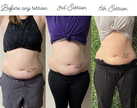 Image result for Body Contouring Design