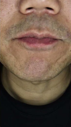 ASMR | Mini Chocolate Eggs 🍫 #DoctorTristanPeh #ASMR