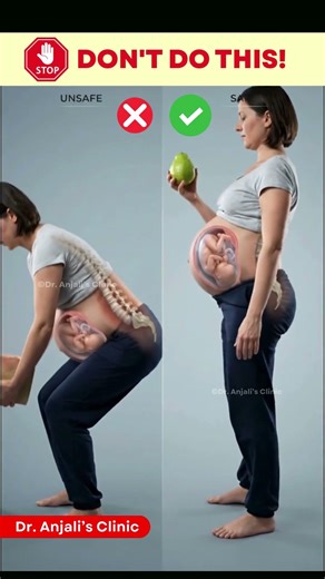 Most Pregnant Women Bend Like This – It’s Wrong