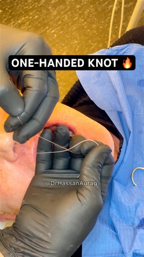 Wisdom Tooth Extraction + One-Handed Surgical Knot 🔥 | Fast & Clean Technique