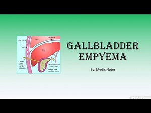 Gallbladder empyema - etiology, clinical features, ultrasound and CT features, treatment, Ddx