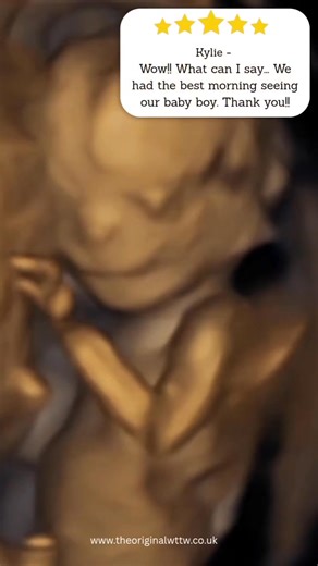 ✨ BOOK NOW – Your unforgettable baby scan experience awaits! ✨ Here’s what we offer at The Original Window to the Womb: 💗 Scans from 12 weeks for reassurance 💗 Gender scans from 15 weeks – with our magical gender reveal lights! 💡💙💖 ✨ As we talk you through your scan, the lights softly glow pink or blue as your baby’s gender is revealed – truly unforgettable! 💗 Breathtaking 3D/4D/HDLIVE scans 💗 Optional 8K image transformation upgrade – turn your scan into stunning lifelike images 💗 Retur