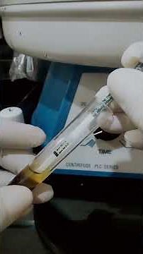 Pemeriksaan Metode Cepat Hepatitis B (HBV) Rapid Test