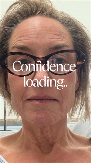 Garrett Locketz, MD, FACS on Instagram: "55 never looked so good! I mean, seriously. Come on. If confidence can be captured in a single video. This is it. This wonderful patient came to me feeling like her appearance no longer matched her inner vitality. She’s physically active, socially engaged, and professionally accomplished, yet the signs of aging in her face and neck were beginning to wear her down. Now she’s feeling refreshed, rejuvenates, and revitalized. Details: - Modified Preservation
