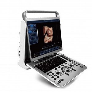 [Hot Item] 4D Portable LED Color Doppler Ultrasound Scanner, Ultrasound Machine