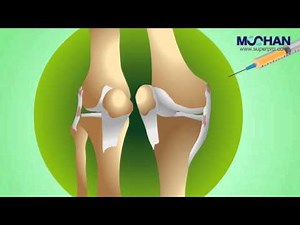 PRP(Platelet Rich Plasma) Kit TUBEX Operation animation [MOOHAN Enterprice]